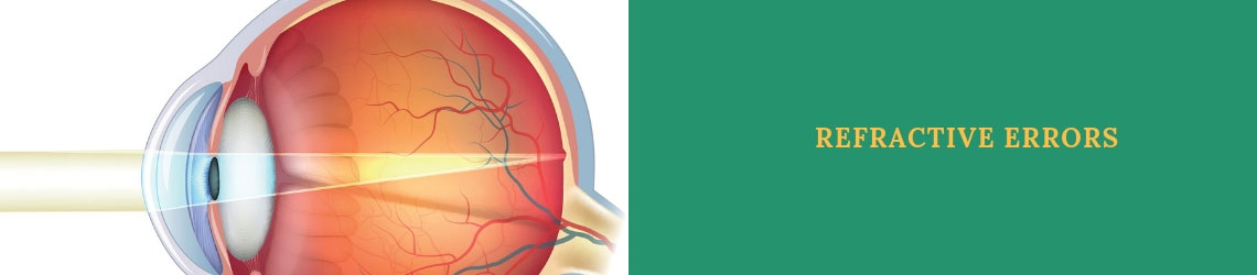 Top 10 Eye Care hospitals in Bellandur | Nelivigi Eye