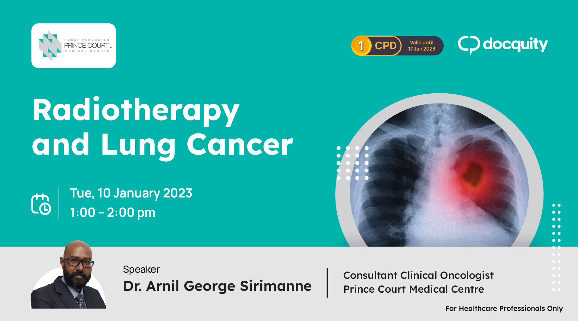 Radiotherapy and Lung Cancer
