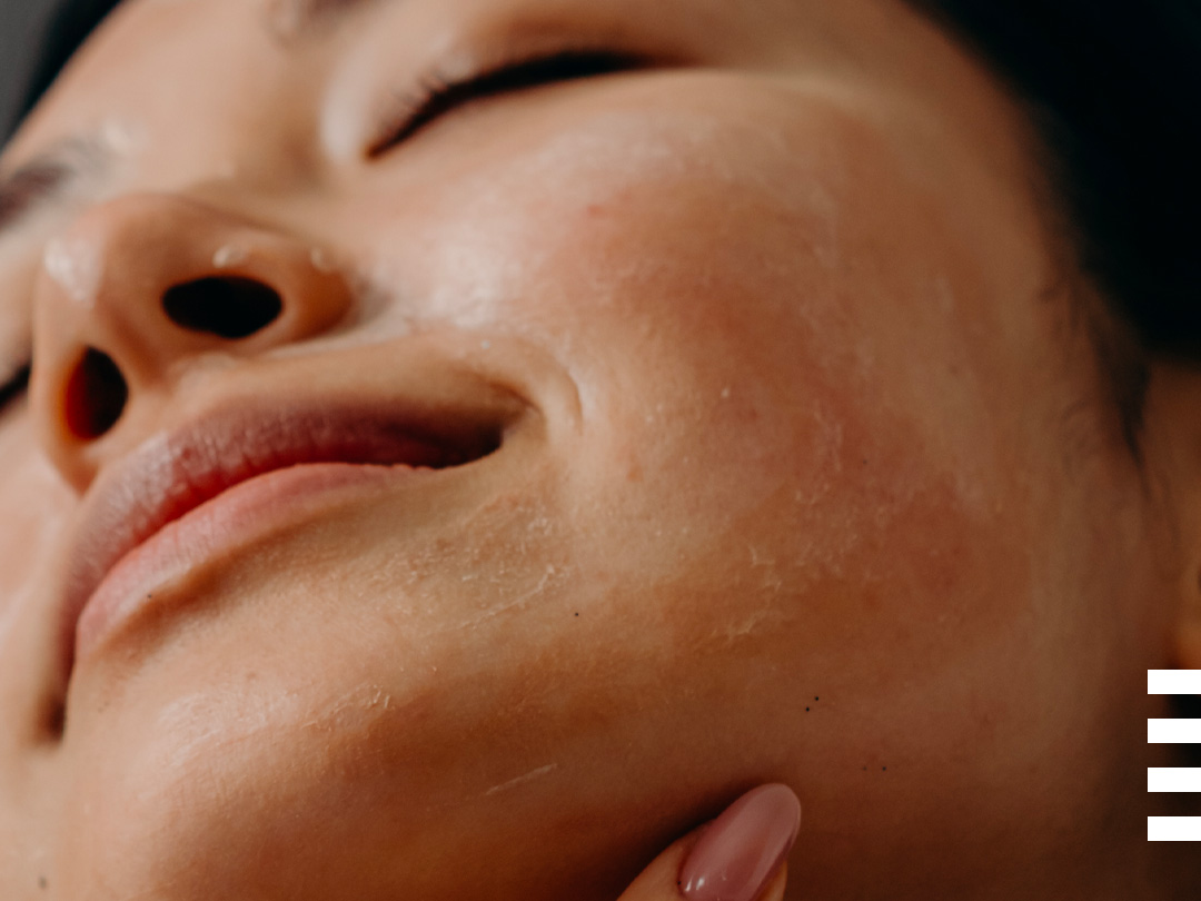 How to Reduce Redness on Face | Sephora Hong Kong SAR