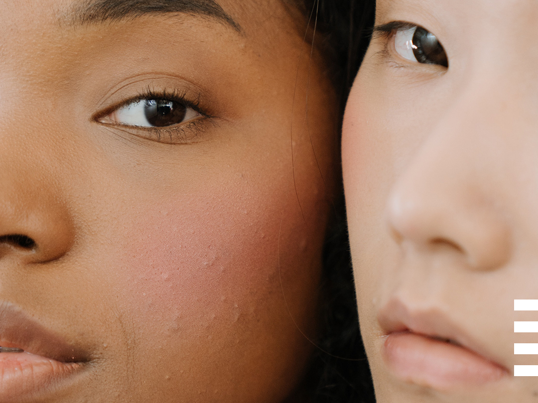 What is My Skin Type? | Sephora Hong Kong SAR