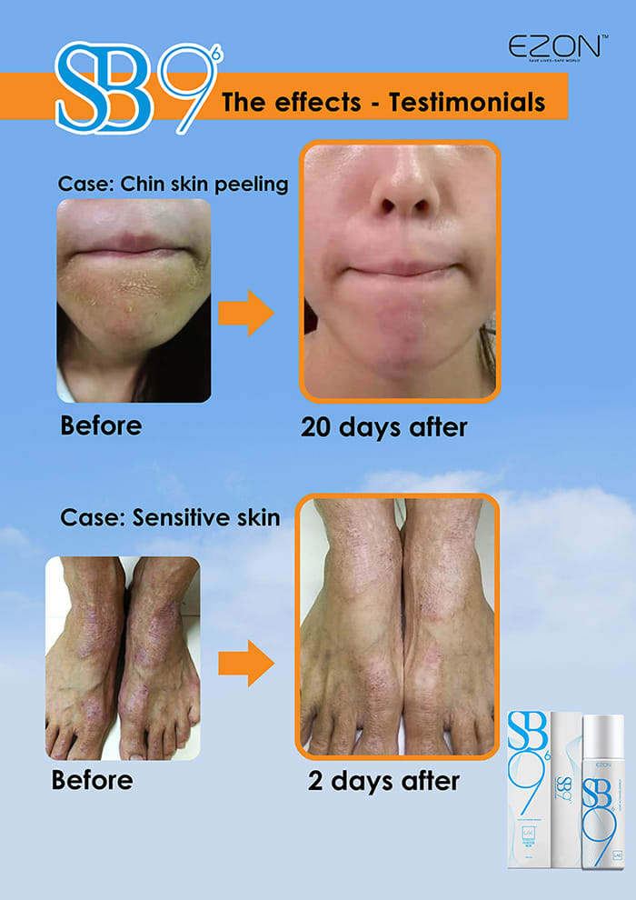 SB96 Buy 3 Free 1 Package