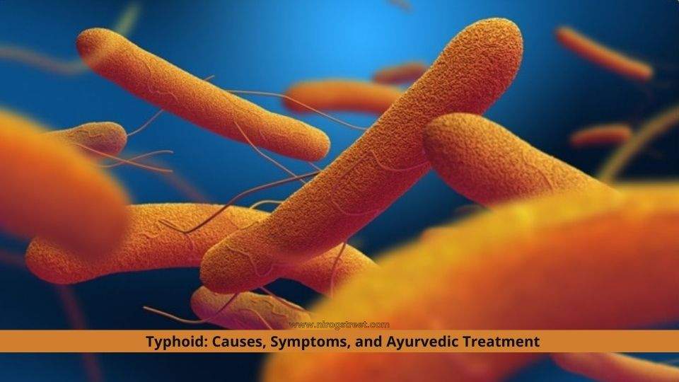 Typhoid: Causes, Symptoms, and Ayurvedic Treatment