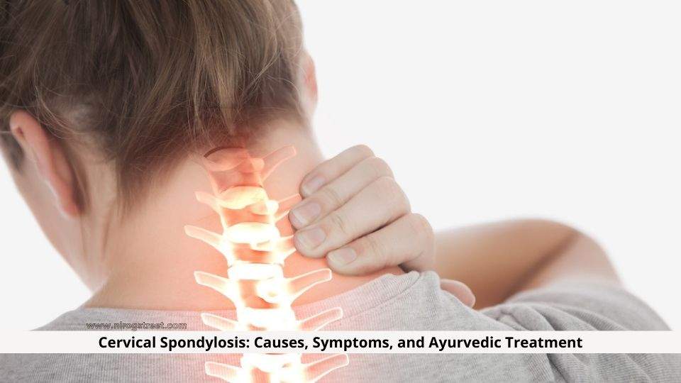 Cervical Spondylosis Causes, Symptoms, and Prevention