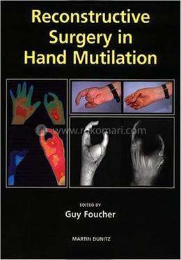 Reconstructive Surgery in Hand Mutilation: Guy Foucher | Rokomari.com