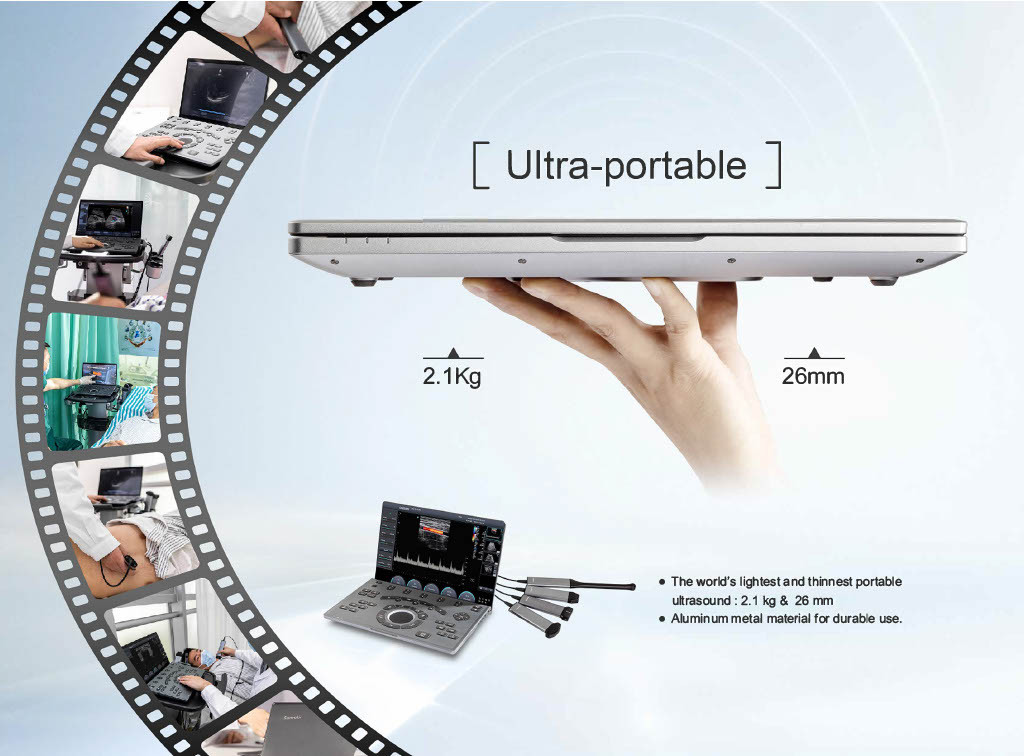 CHISON SONOAIR 30 ULTRASOUND – Ihbhealthcare.com