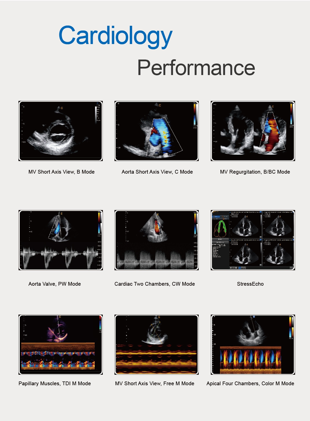 CHISON QBIT 7 ULTRASOUND – Ihbhealthcare.com