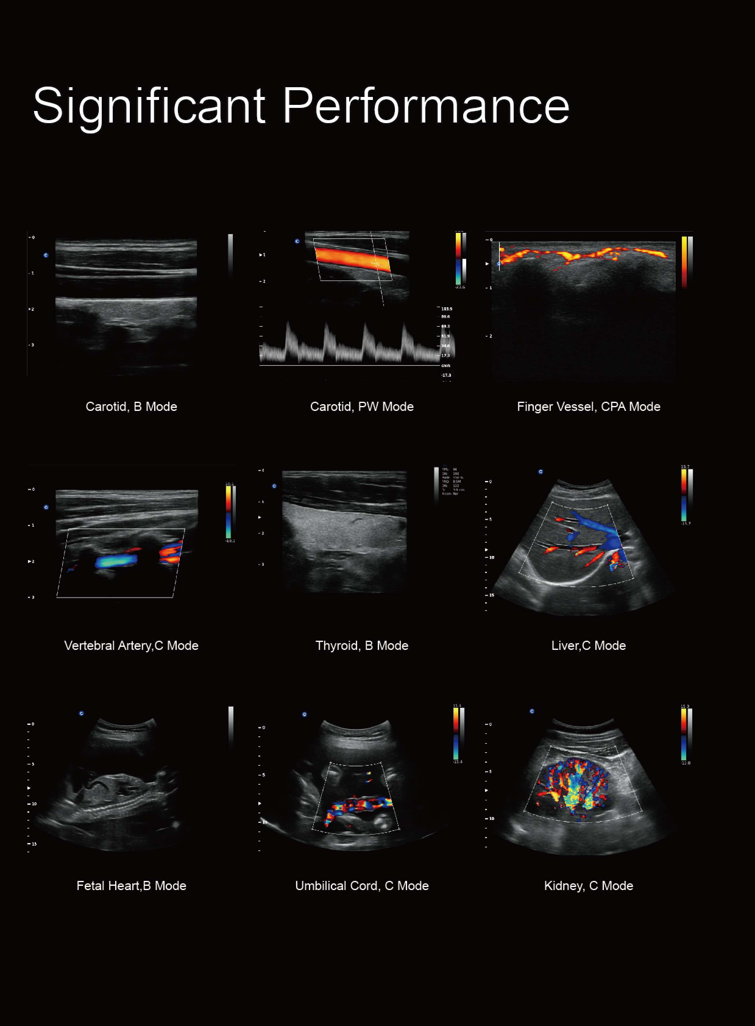 CHISON QBIT 3 ULTRASOUND – Ihbhealthcare.com