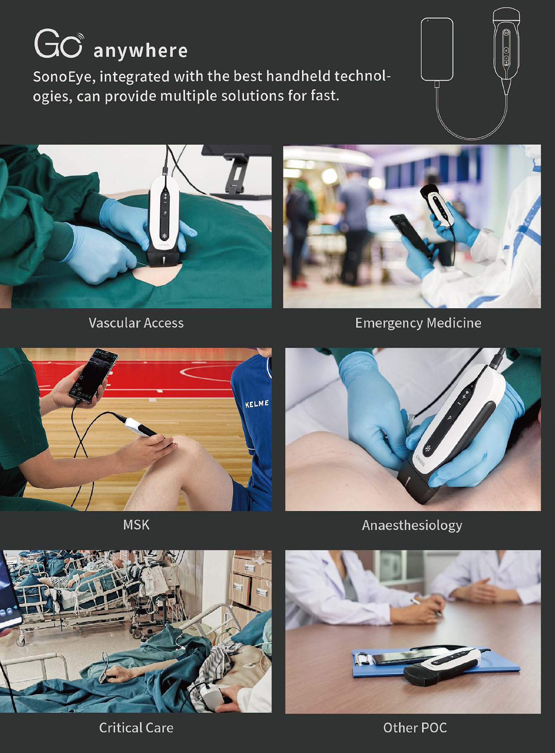 CHISON SONOEYE P5 HANDHELD ULTRASOUND (CONVEX) – Ihbhealthcare.com