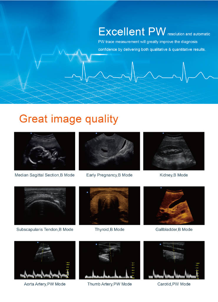 CHISON ECO 2 PORTABLE ULTRASOUND – Ihbhealthcare.com