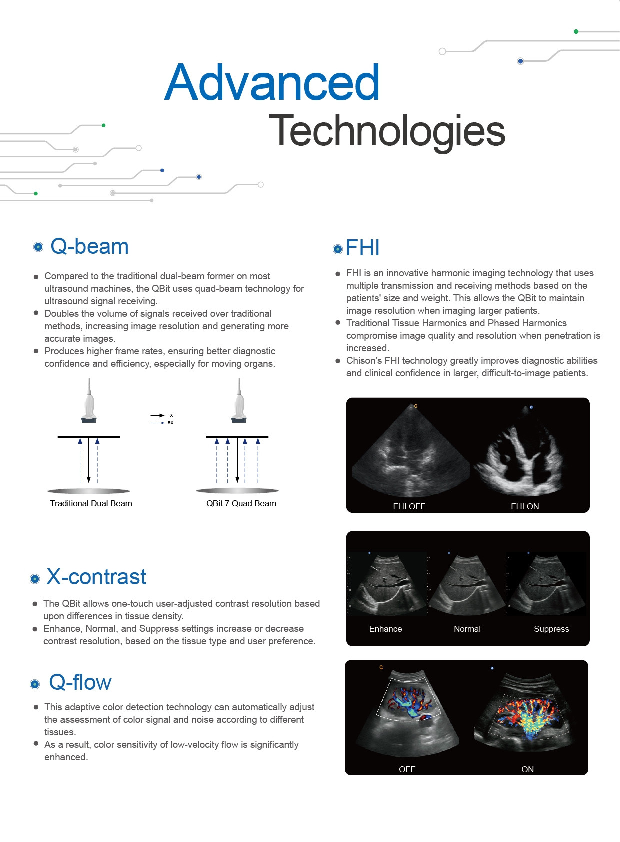 Chison Qbit 7 Ultrasound
