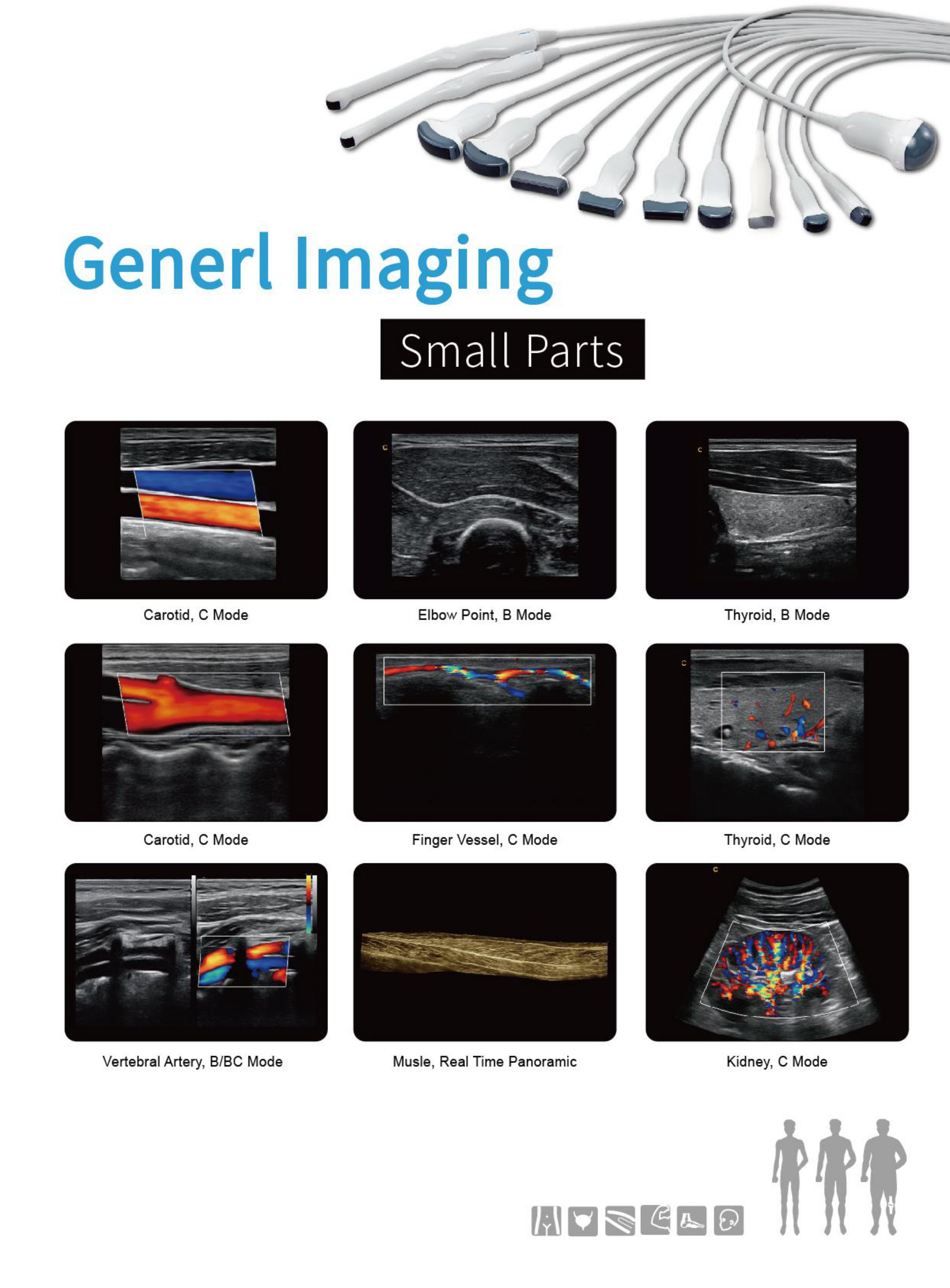 CHISON QBIT 9 ULTRASOUND – Ihbhealthcare.com